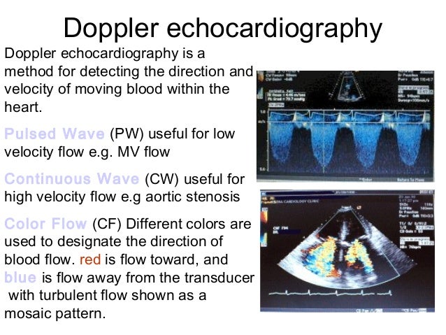 Echocardiography Cardiac Ultrasound