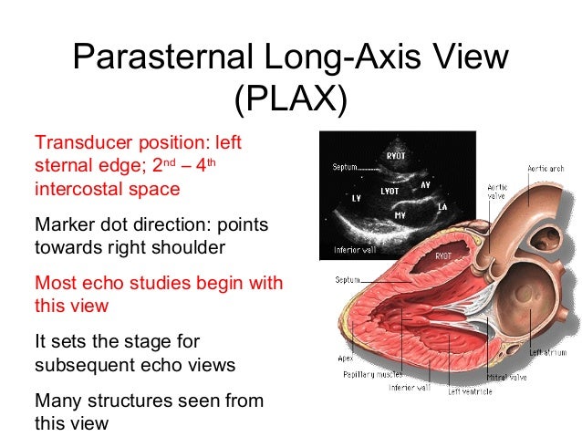 Echocardiography Cardiac Ultrasound