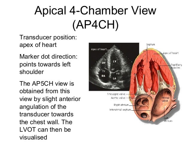 Echocardiography Cardiac Ultrasound