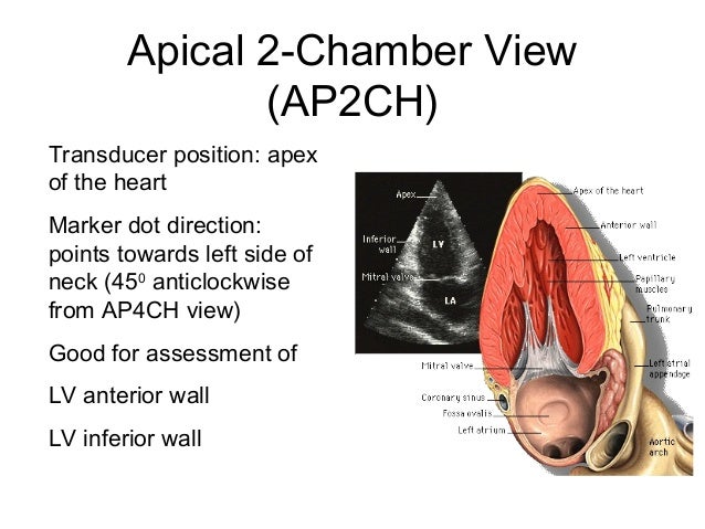 Echocardiography Cardiac Ultrasound