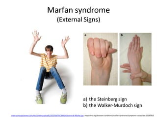 Systemic Connective Tissue Diseases | PPT