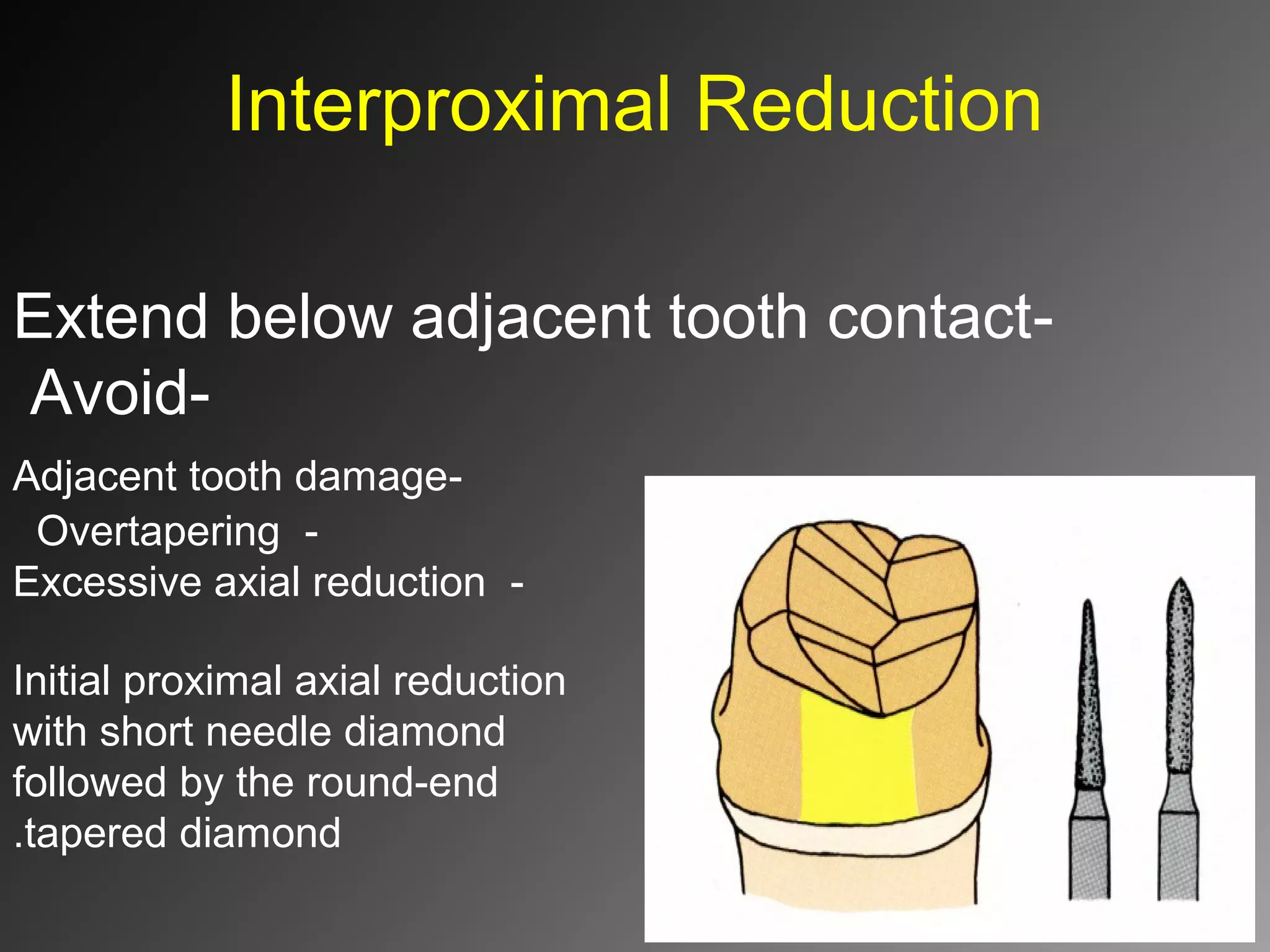 5.full metal crown | PPT