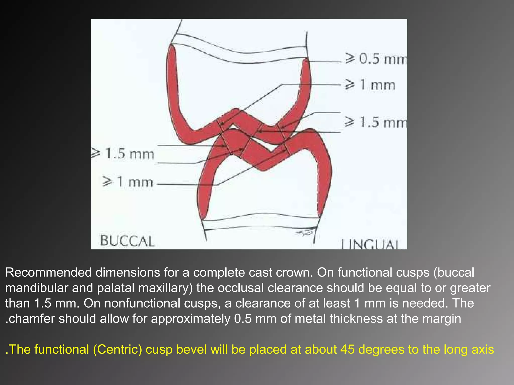 5.full metal crown | PPT