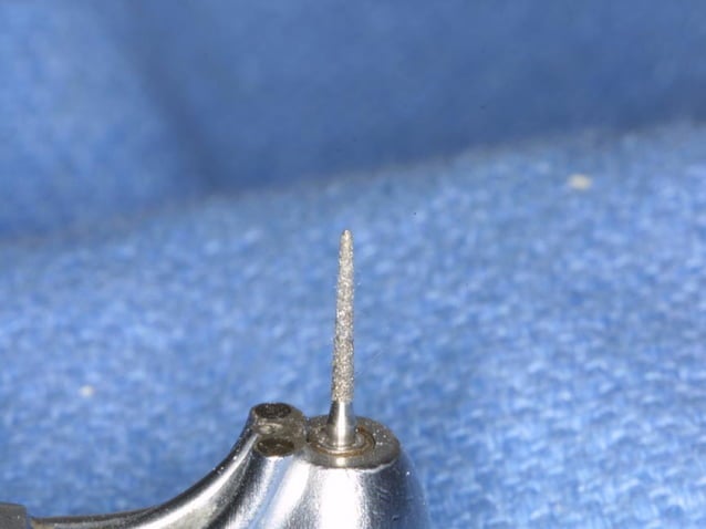 5.full metal crown | PPT