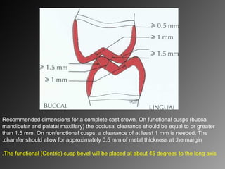 5.full metal crown | PPT