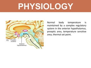 Pyrexia of unknown origin (PUO) | PPTX