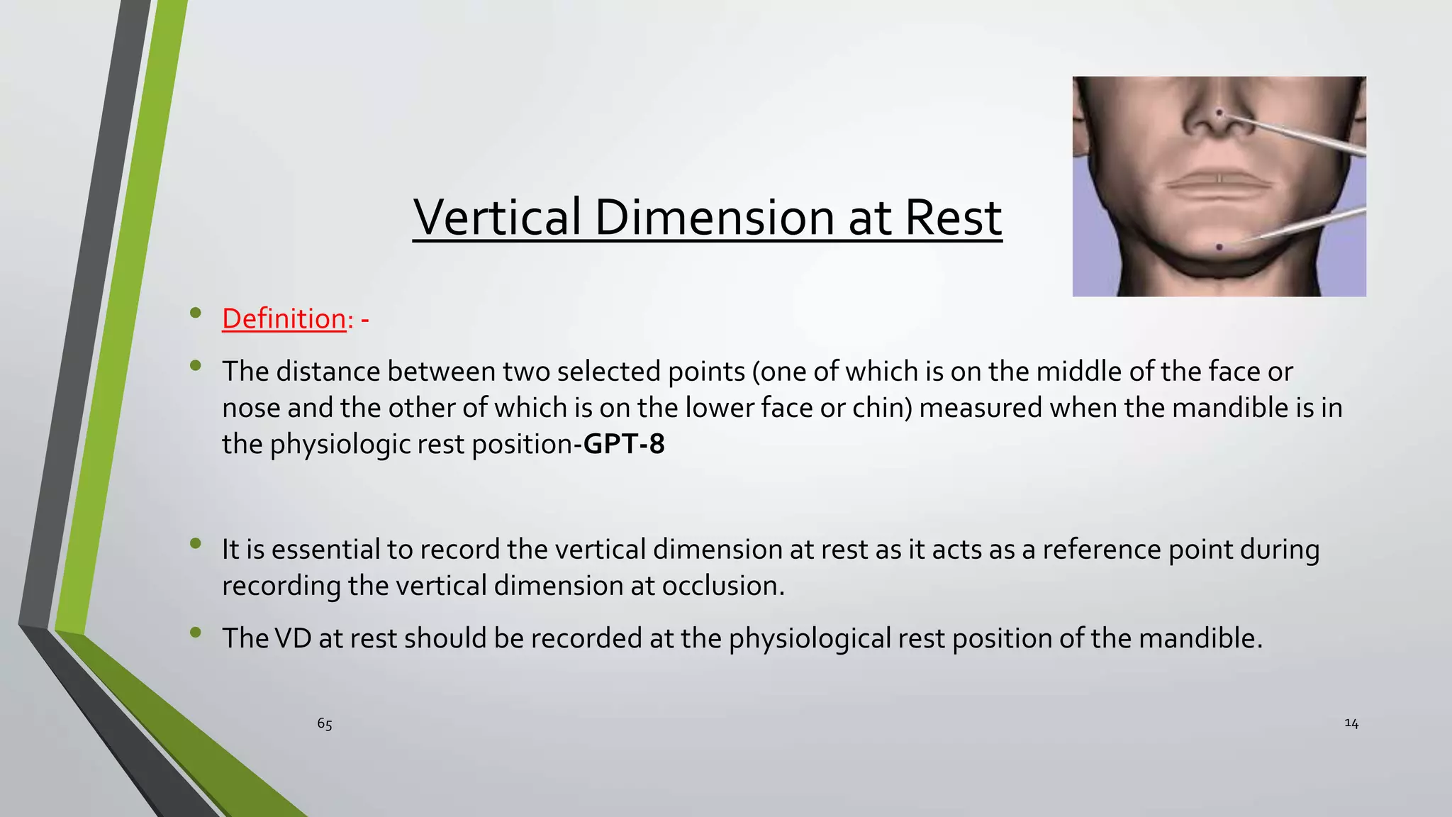 Vertical jaw relation in Complete Dentures- Kelly | PPTX