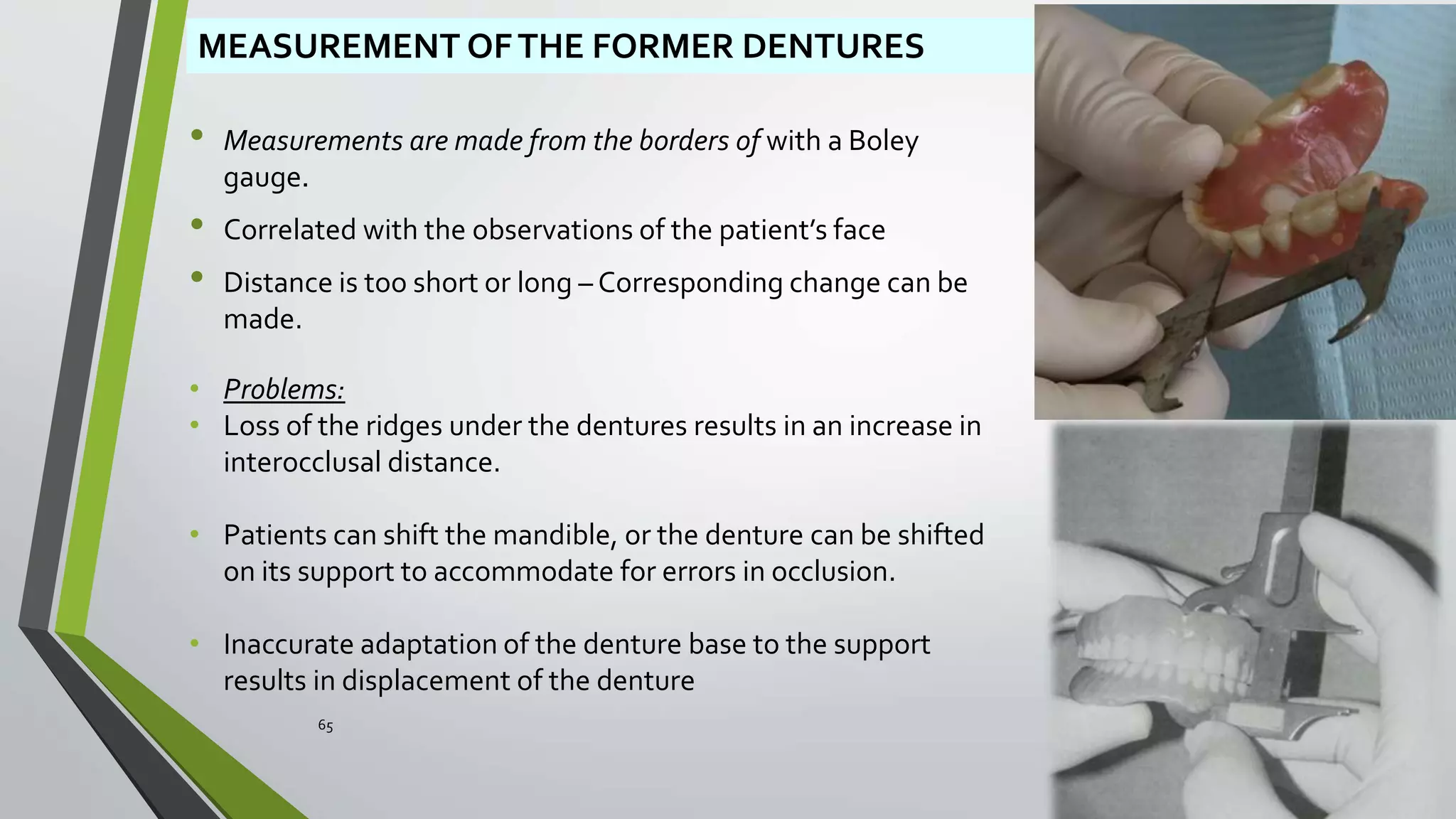 Vertical jaw relation in Complete Dentures- Kelly | PPTX
