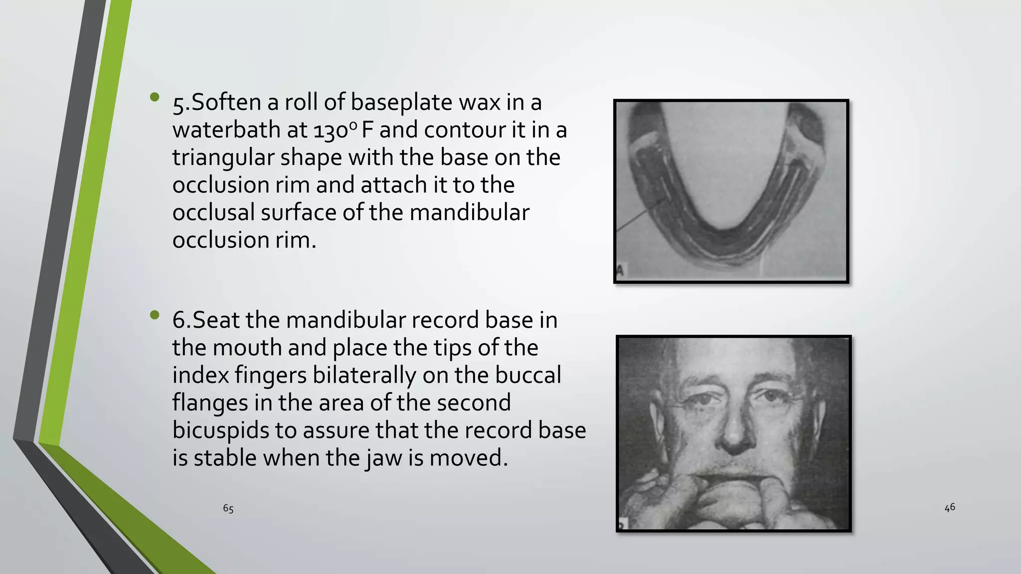 Vertical jaw relation in Complete Dentures- Kelly | PPTX