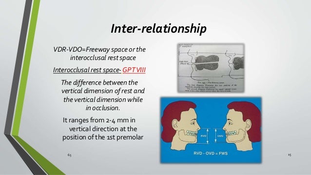 Vertical jaw relation in Complete Dentures- Kelly