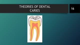 Dental caries | PPT