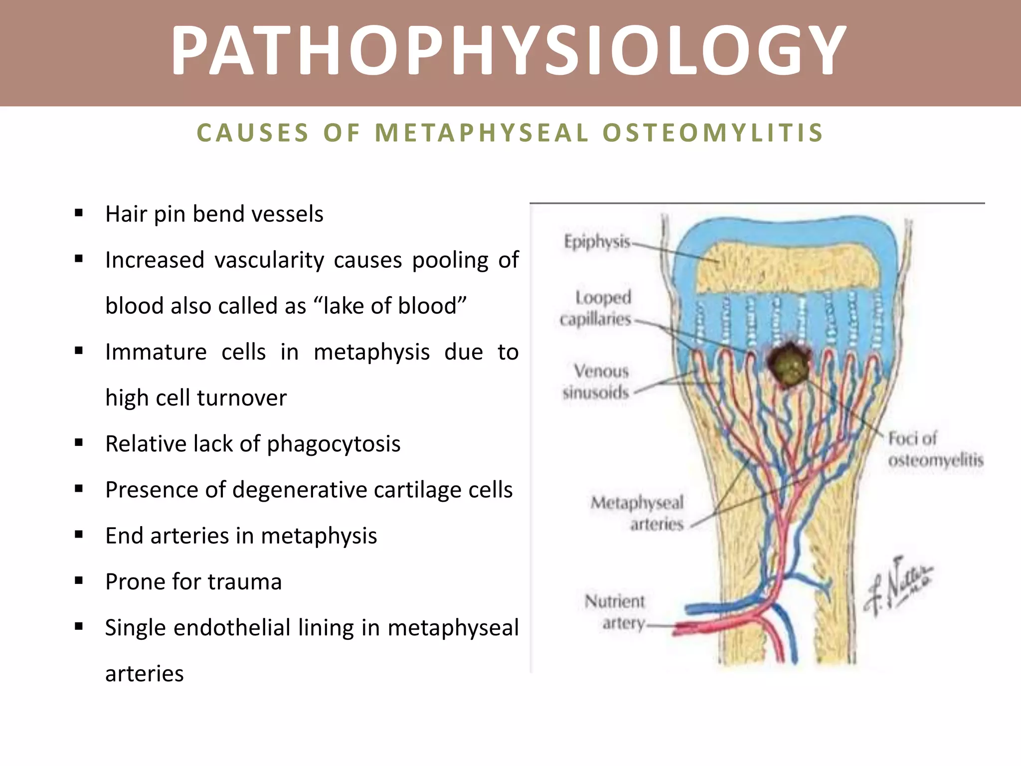 Acute Osteomyelitis | PPTX
