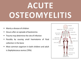 Acute Osteomyelitis