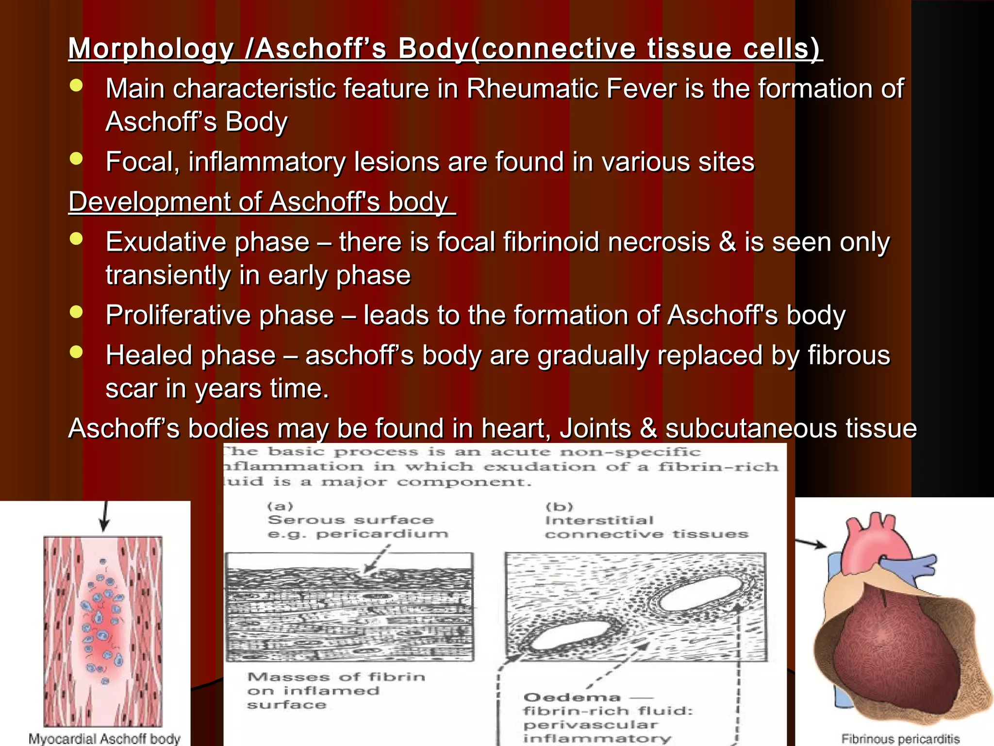5.Rheumatic heart disease pathology | PPT