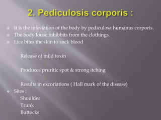 Pediculosis Corpus