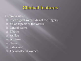 5. Scabies and pediculosis | PPTX