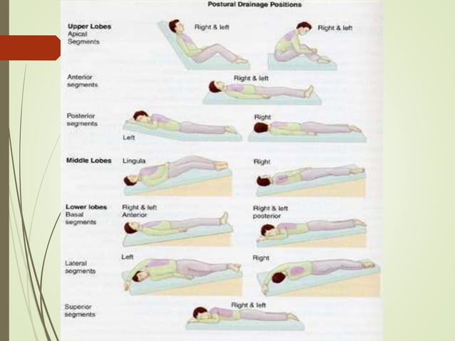 Postural drainage | PPTX