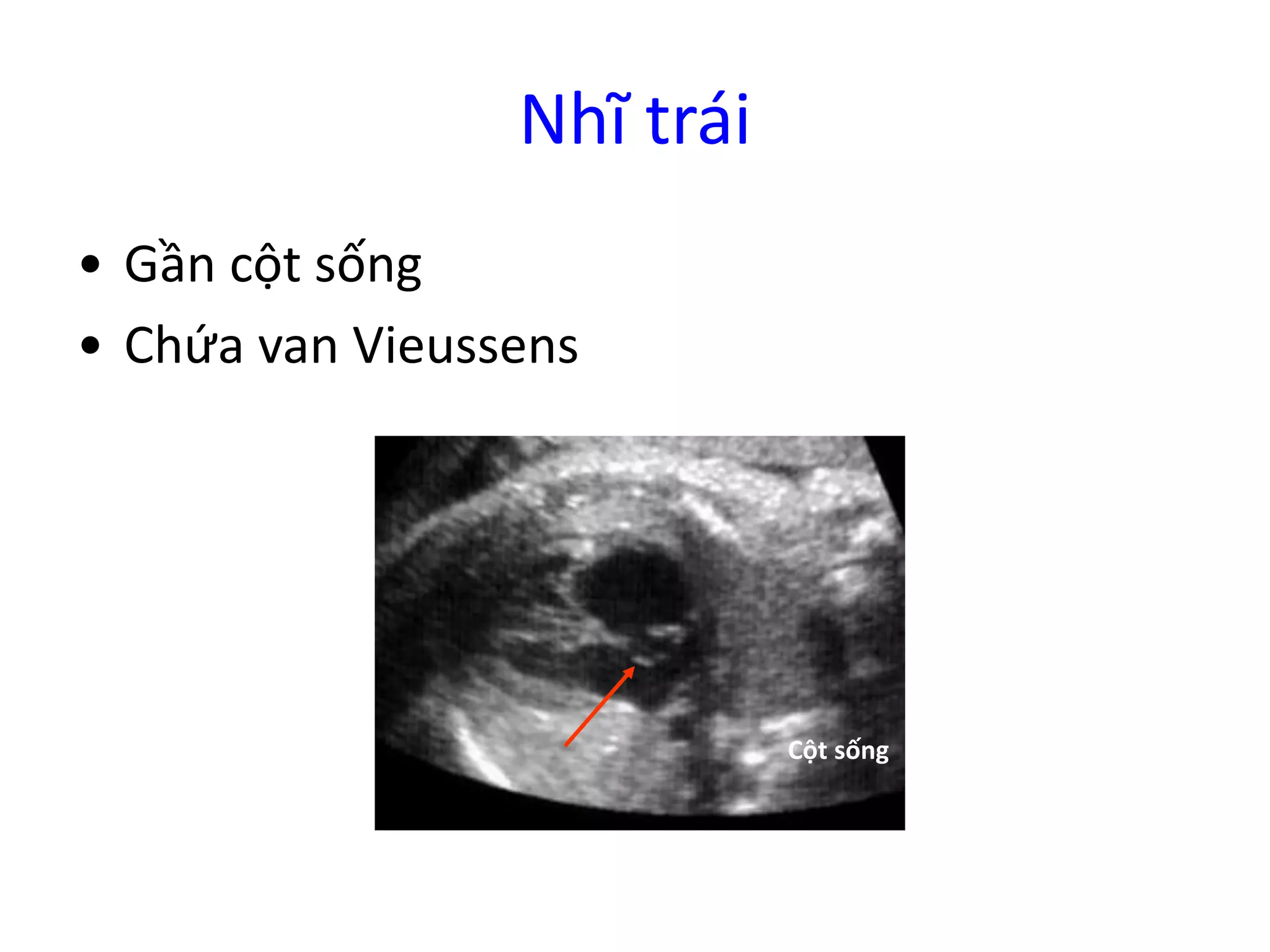 5. Sieu am tim thai binh thuong, GS Michel Collet | PDF