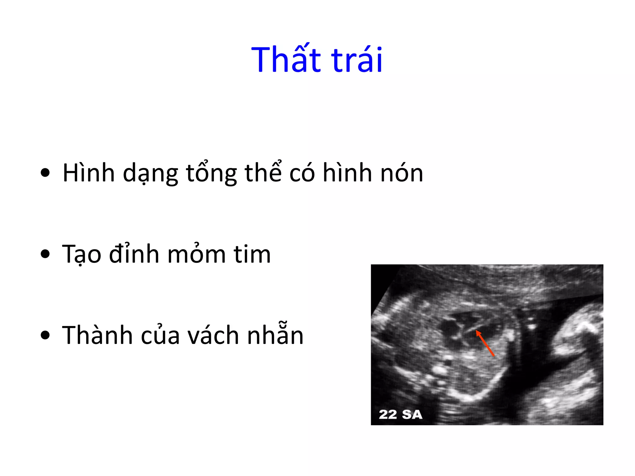 5. Sieu am tim thai binh thuong, GS Michel Collet | PDF