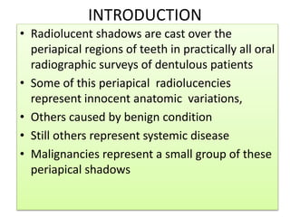 Periapical radiolucencies | PPTX