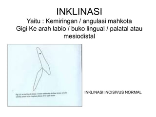 5. alignment artikulasi gigi geligi | PPT