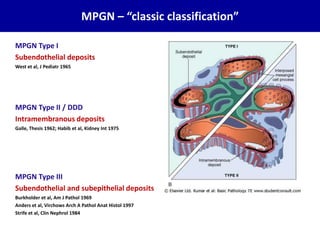 5-2. C3 glomerulonephritis and Dense Deposit Disease. Francesco Emma ...