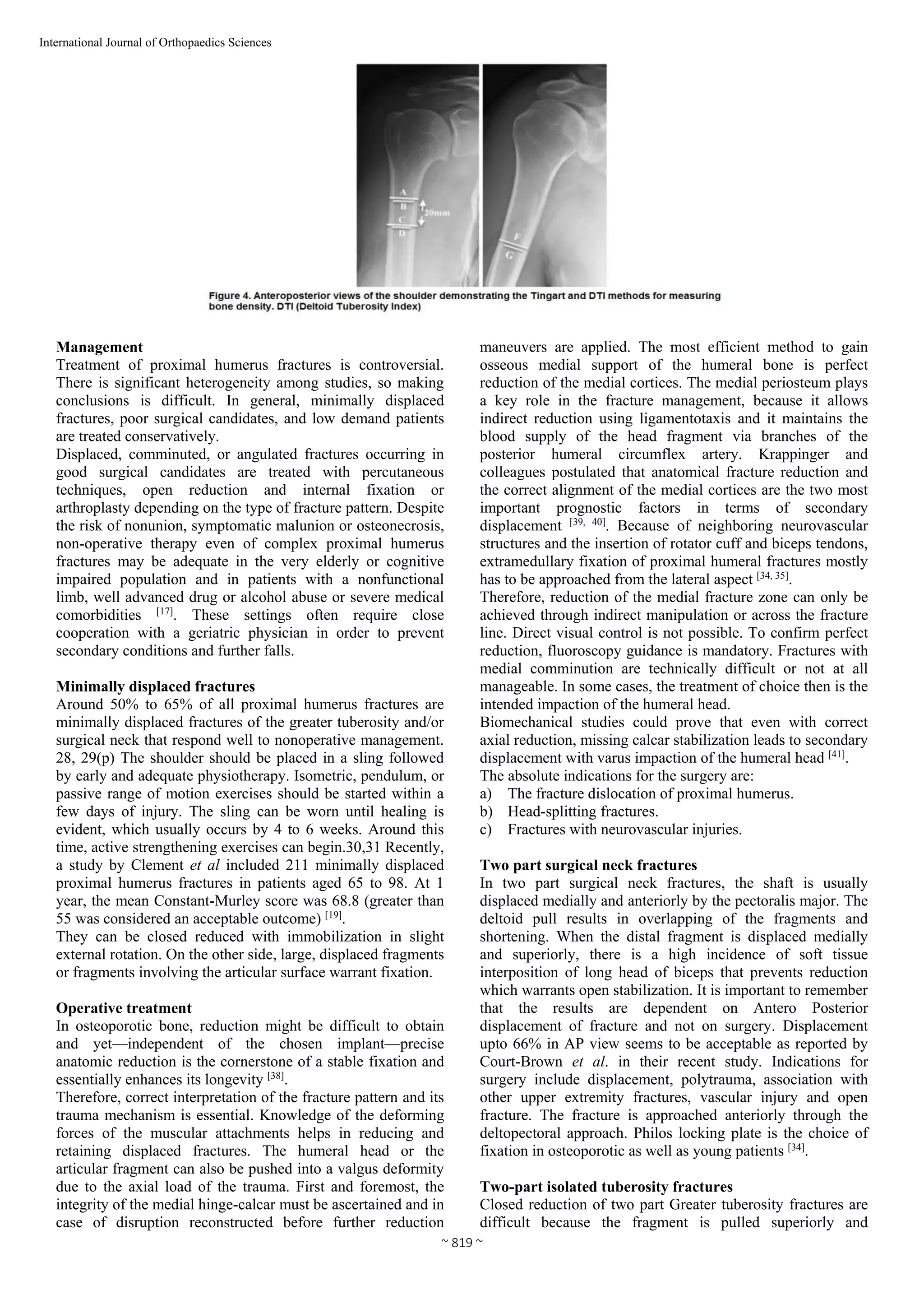 Proximal Humerus Fractures | PDF