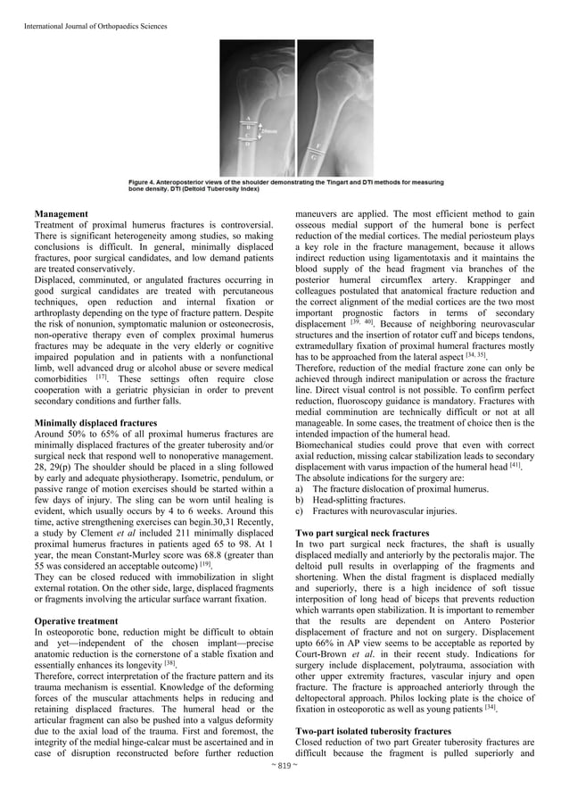 Proximal Humerus Fractures | PDF