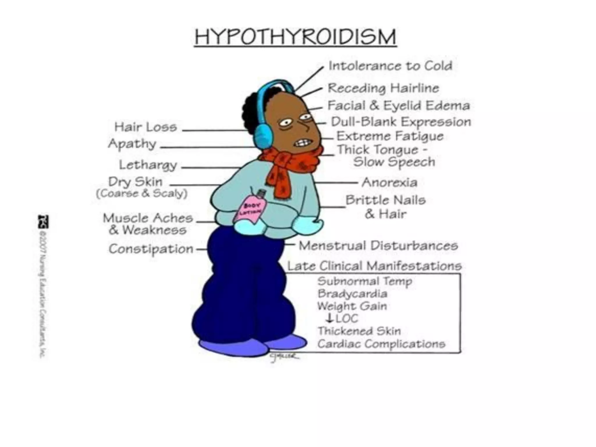 5 Thyroid Disorder Hypo And Hyper Pdf Thyroid Disorders Endocrine