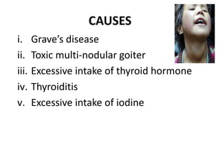 5. thyroid disorder hypo & hyper | PDF