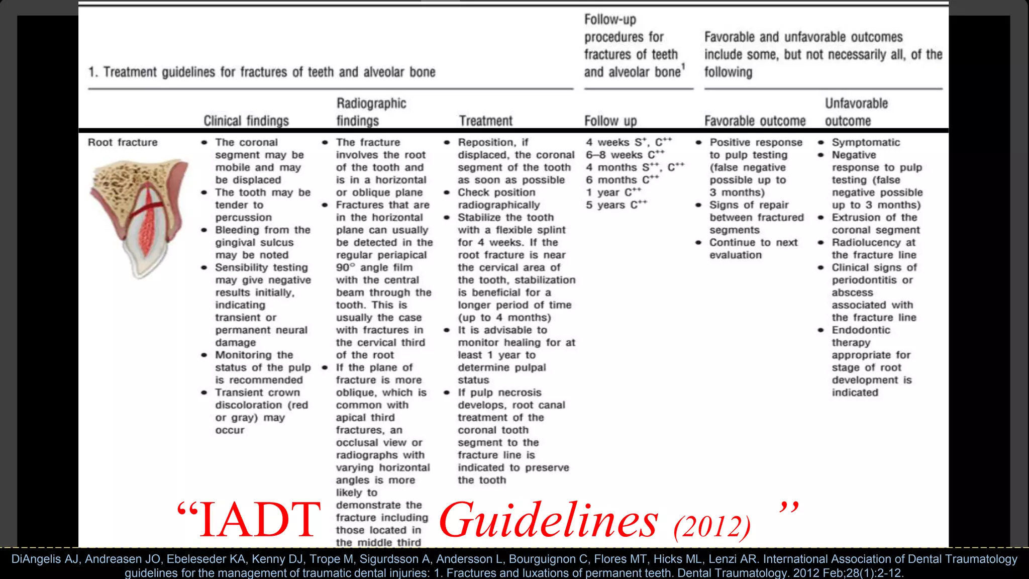 Management of Tooth fracture | PPTX