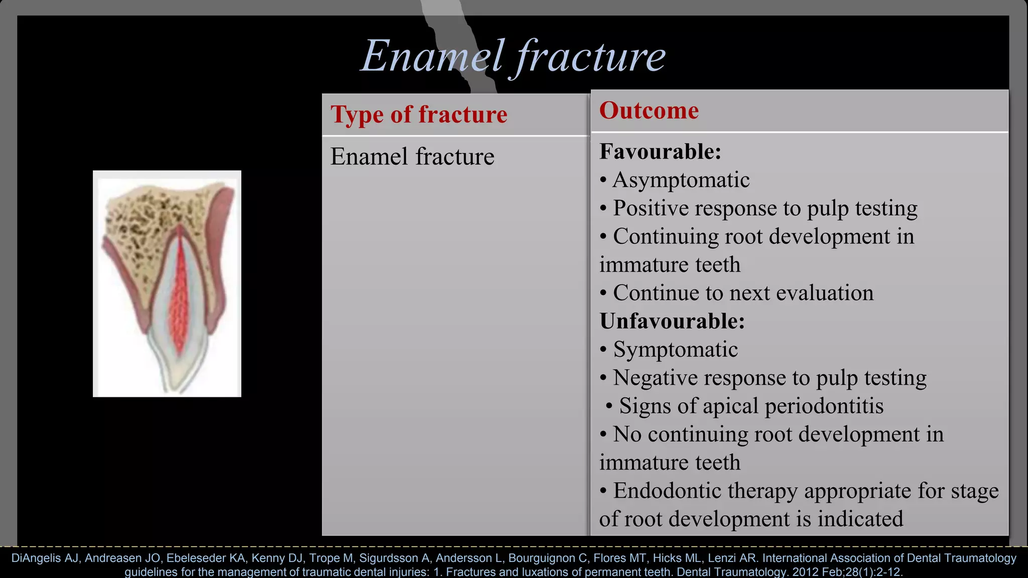Management of Tooth fracture | PPTX