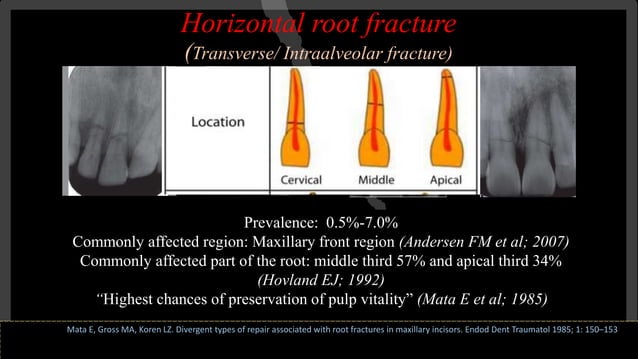 Management of Tooth fracture | PPTX | Bone and Joint Conditions ...