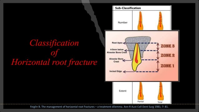 Management of Tooth fracture | PPTX | Bone and Joint Conditions ...