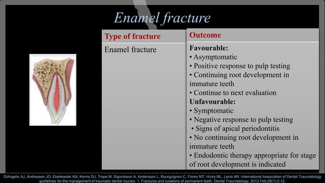 Management of Tooth fracture | PPTX | Bone and Joint Conditions ...