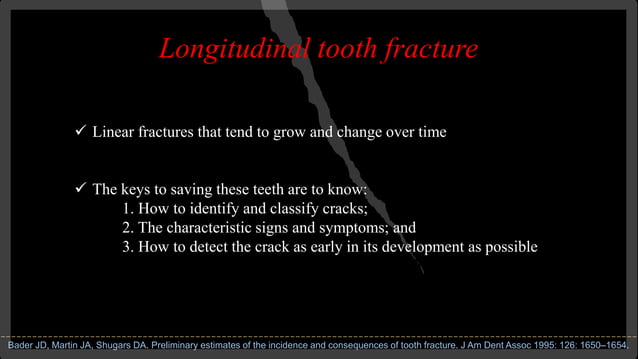 Management of Tooth fracture | PPTX | Bone and Joint Conditions ...