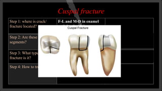 Management of Tooth fracture | PPTX