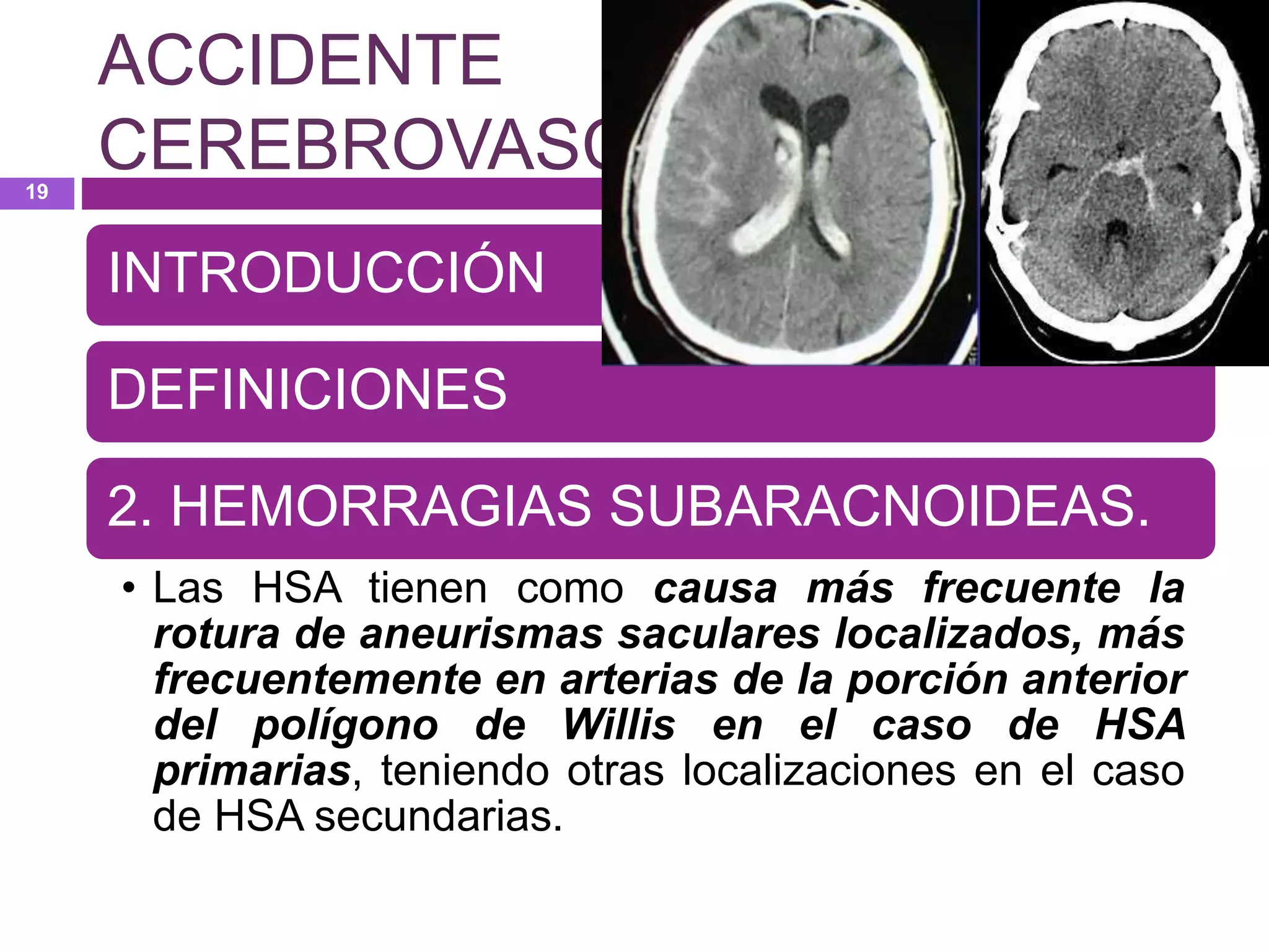 5. accidente cerebrovascular hemorragico | PPTX