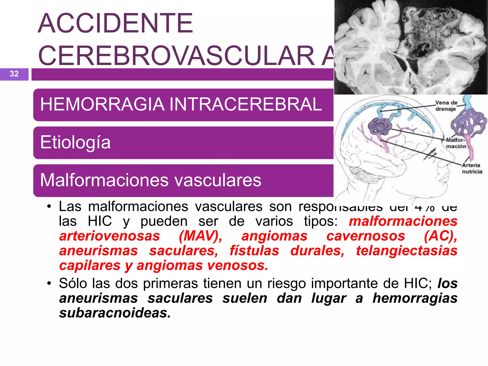5. accidente cerebrovascular hemorragico | PPTX