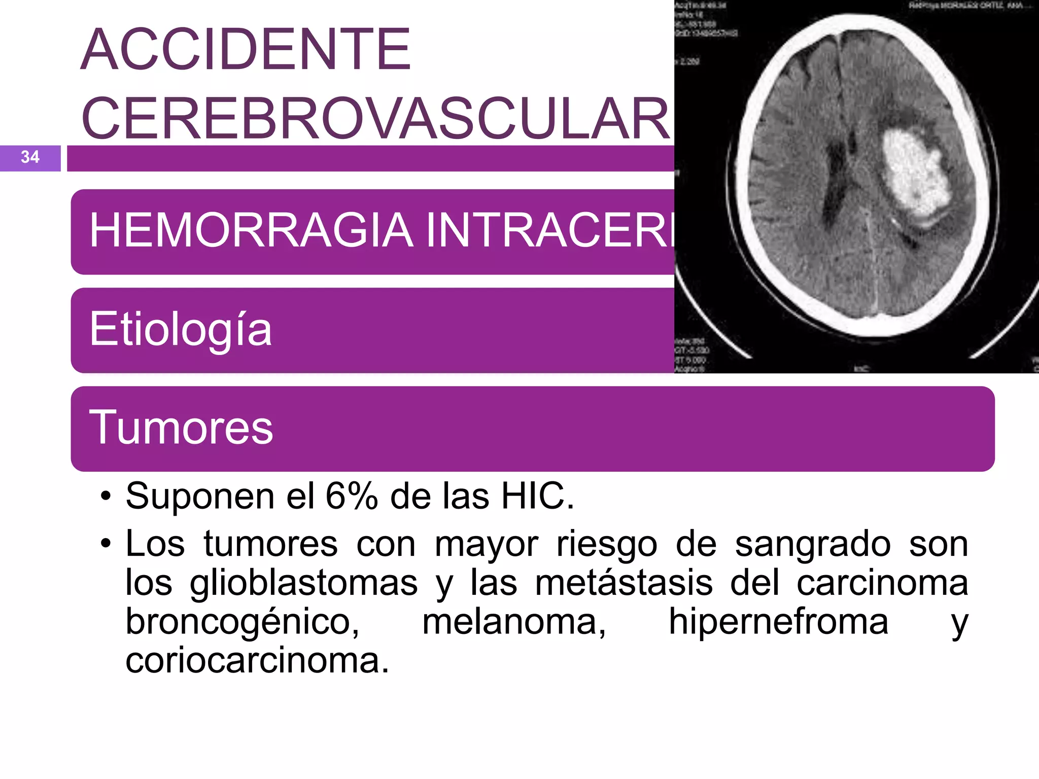 5. accidente cerebrovascular hemorragico | PPTX