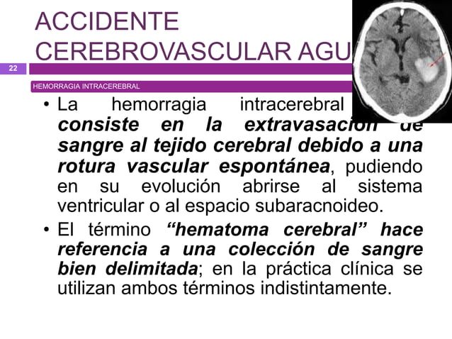 5. accidente cerebrovascular hemorragico | PPTX