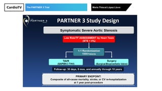 PARTNER 3 Trial | PDF