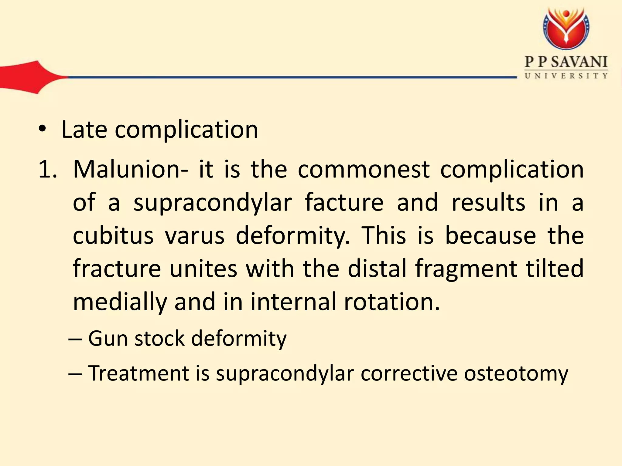 5. Supra Condylar fracture of Humerus | PPTX