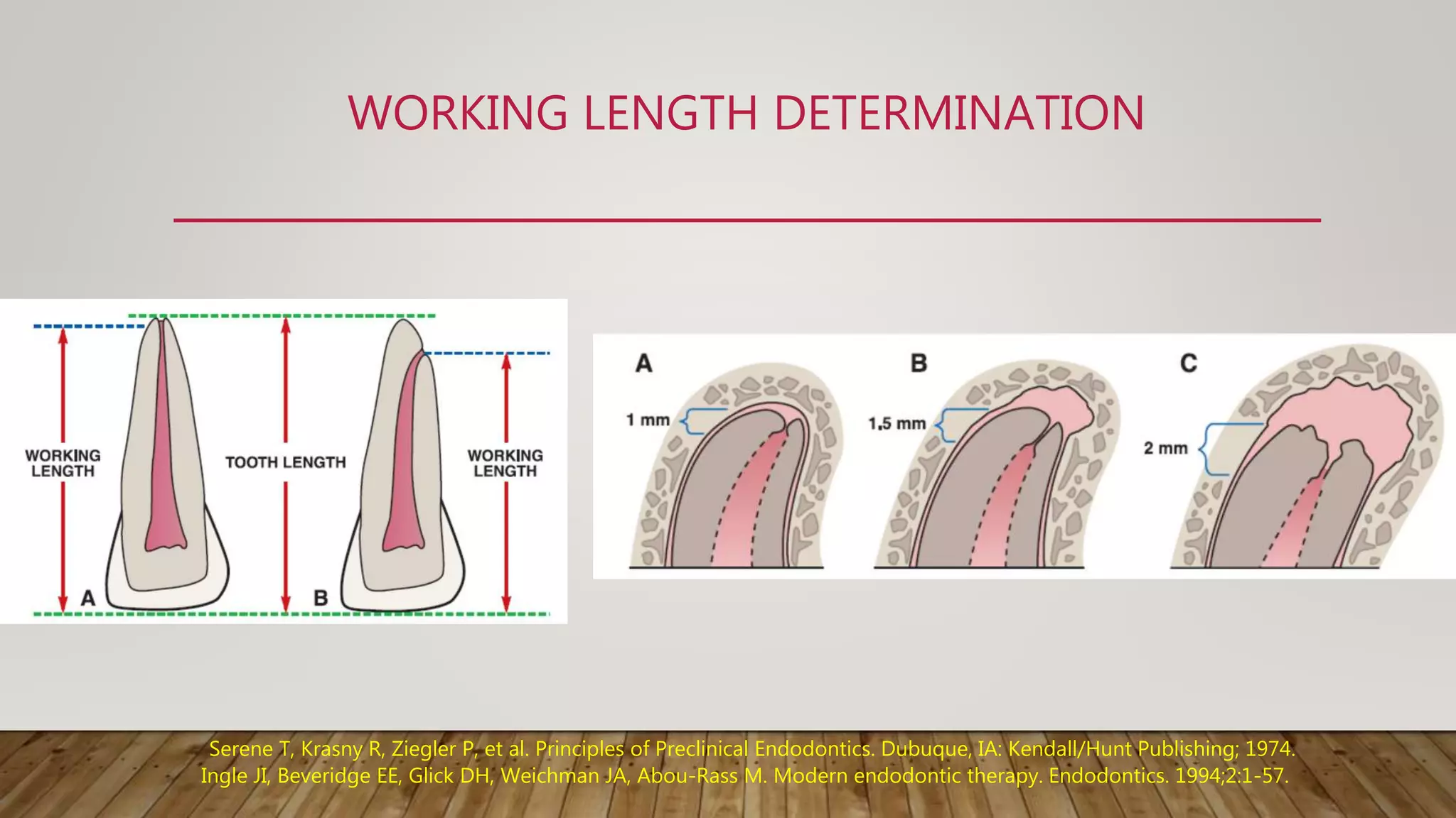 structure of root apex | PPTX