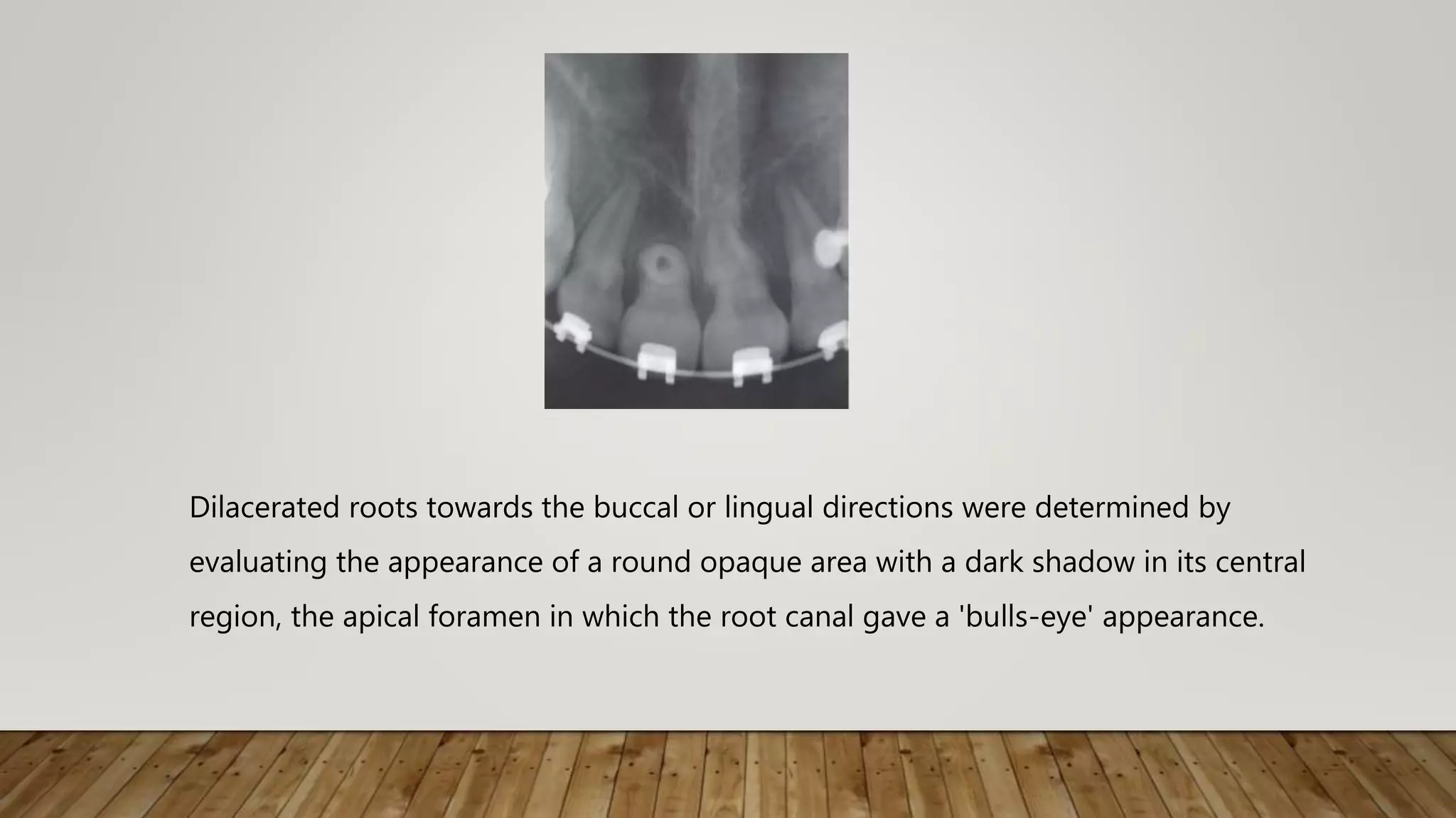 structure of root apex | PPTX