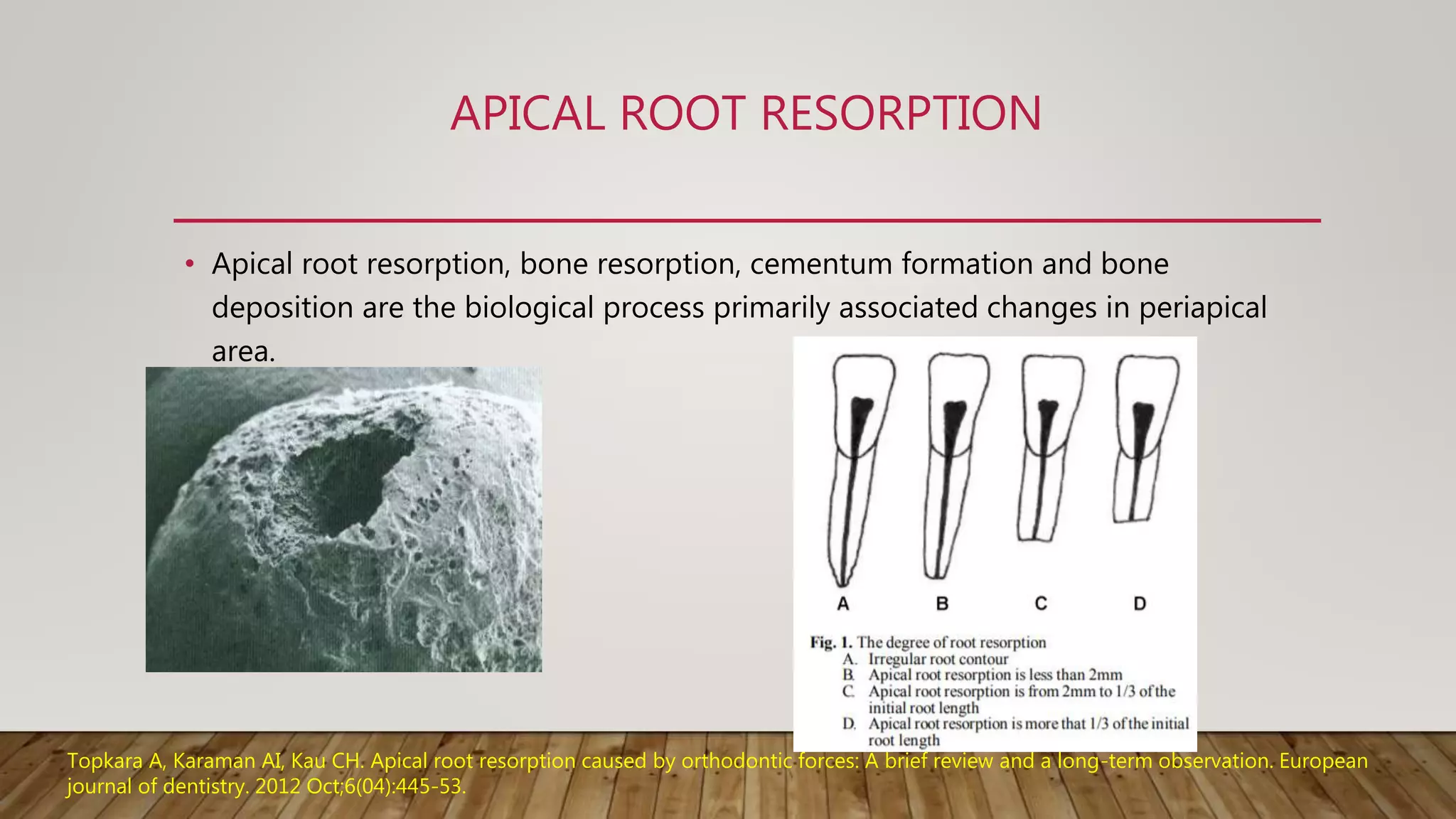 structure of root apex | PPTX