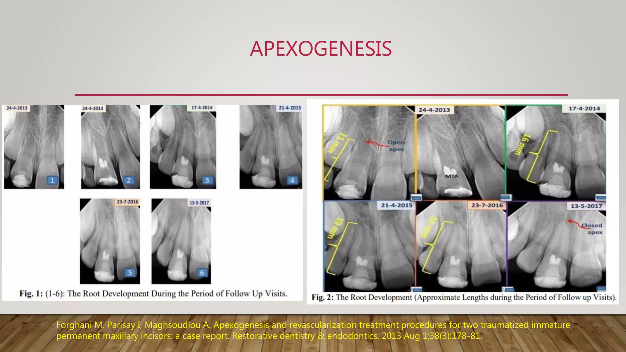 structure of root apex | PPTX