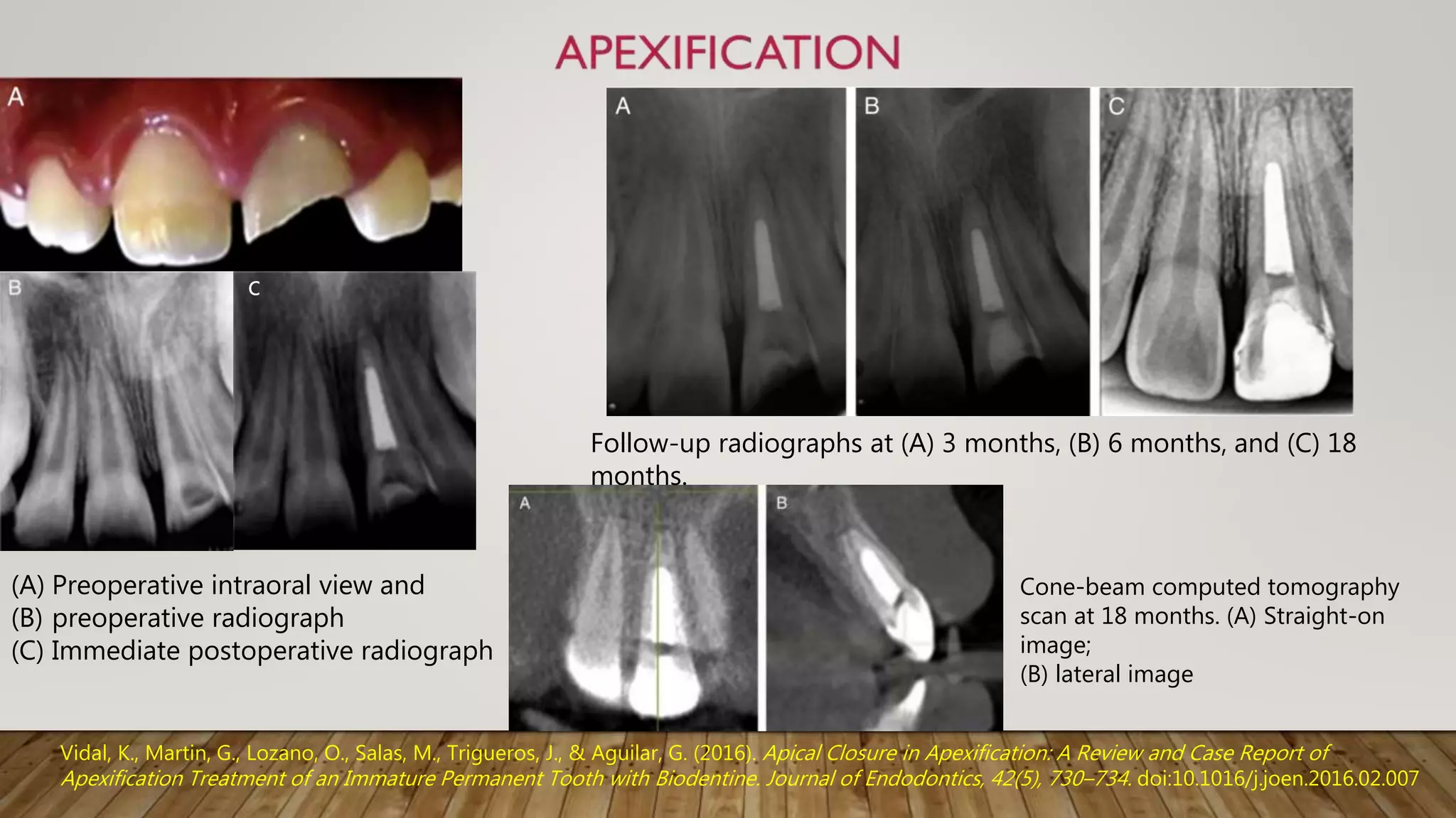 structure of root apex | PPTX