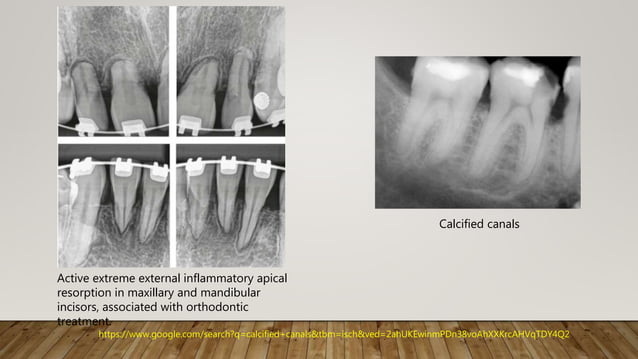 structure of root apex | PPTX | Dental Health | Diseases and Conditions