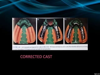 Lab procedures in fabrication of CPD- Dr Prathibha | PPTX